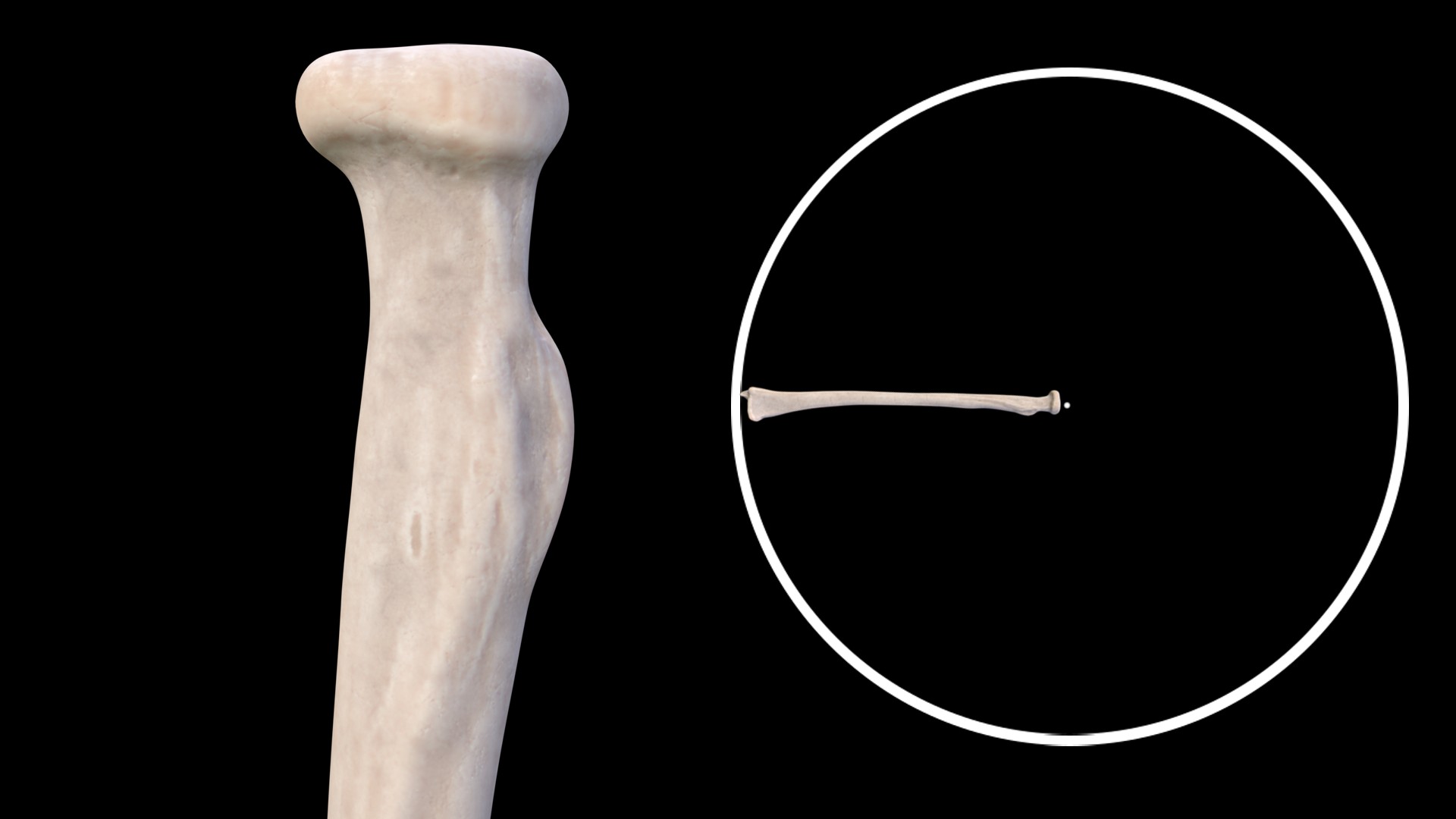 Radius 3d Anatomy Doc Jana